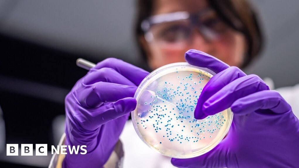 Las bacterias transforman el plástico en plástico en analgésicos | Kancha
